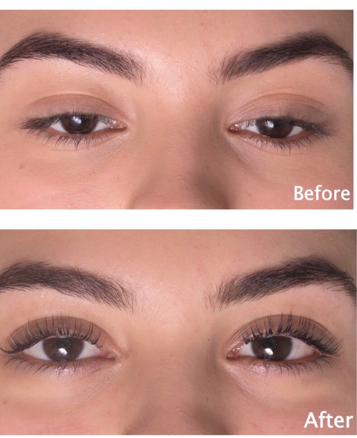 Best Logan Square Brazilian service - The Wax & Skin Lounge